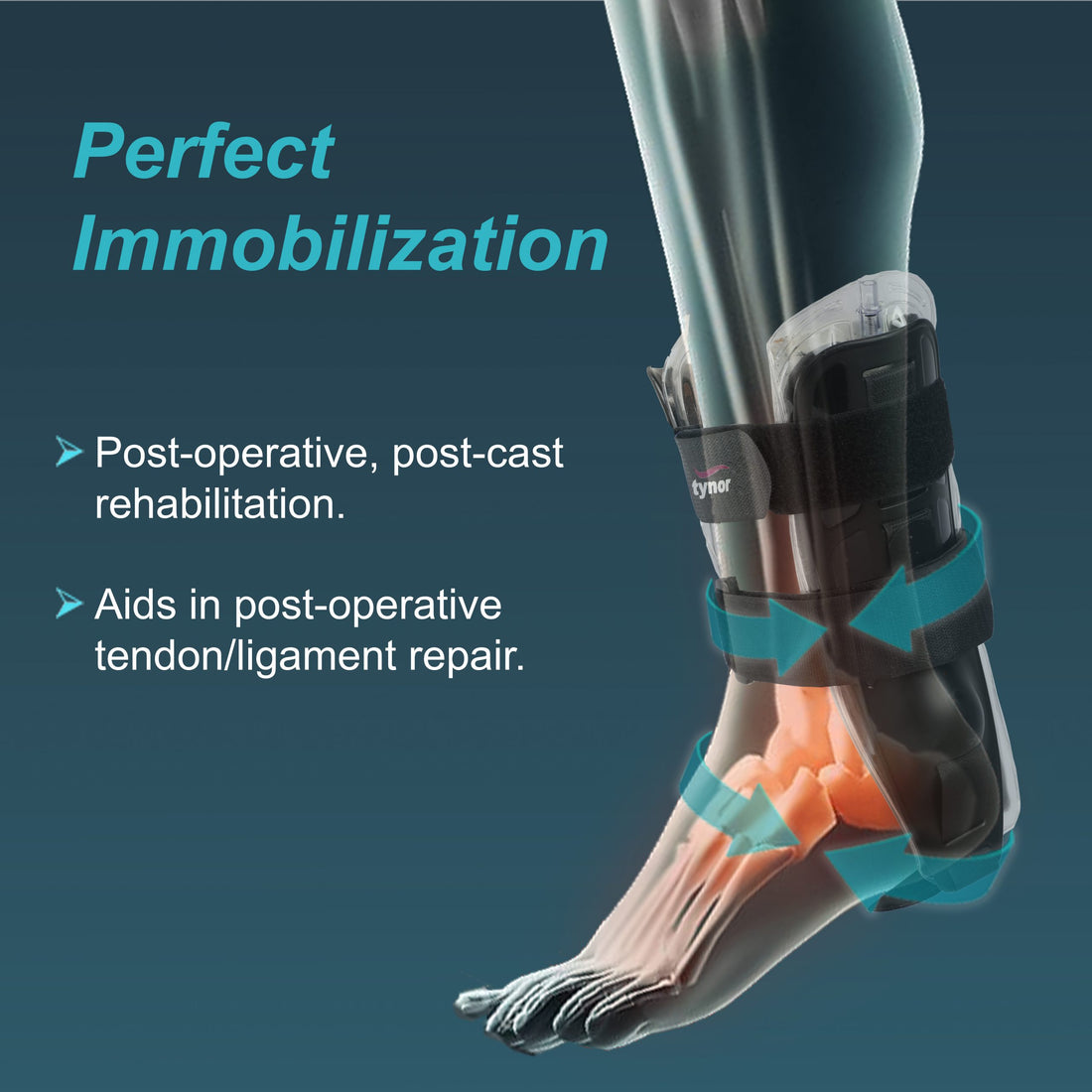 Air Ankle Splint, Black, 1 Unit – MedineedsIndia
